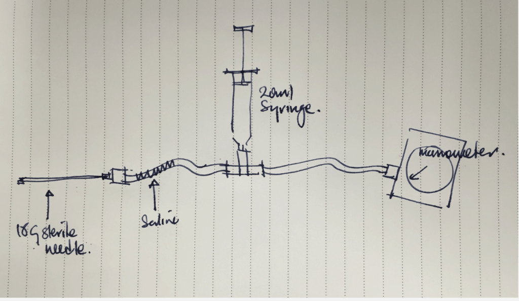 Compartment Syndrome | Emergency Medicine Education | Resus