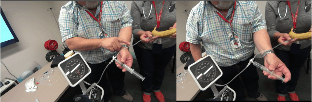 Compartment Syndrome | Emergency Medicine Education | Resus