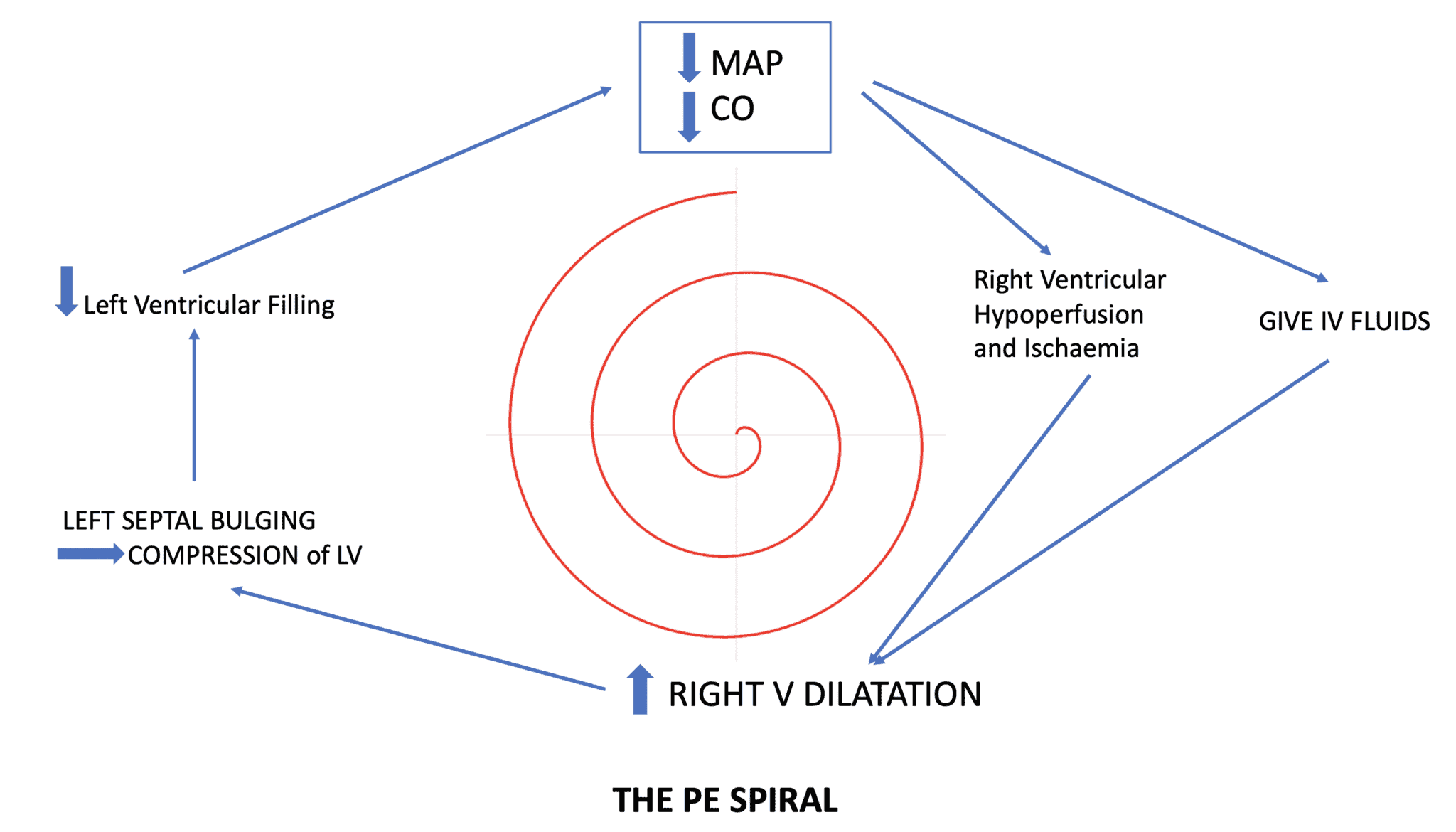The Right Ventricular Spiral of Death | Resus
