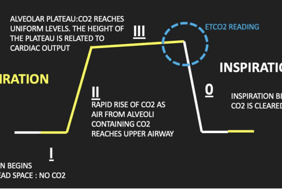 Airway Topics | Emergency Medicine Education | Resus