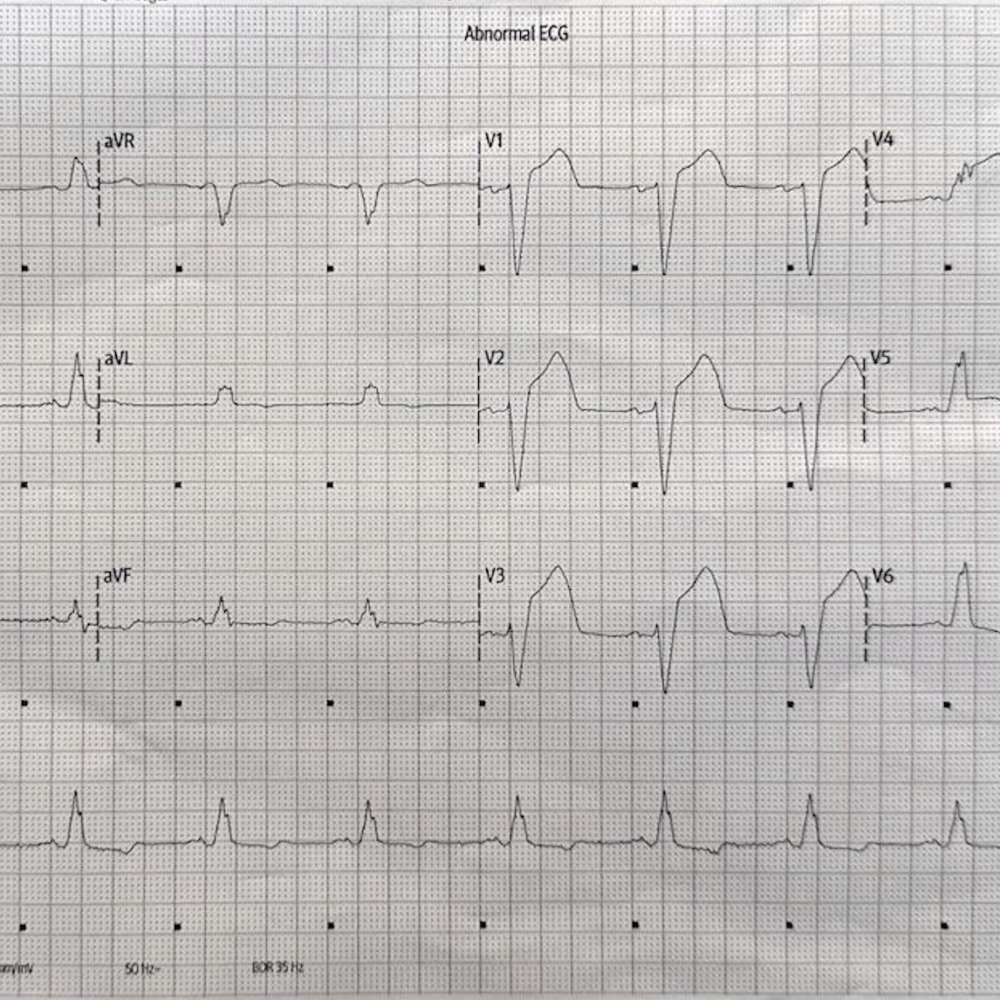 Emergency Medicine Education | Resus