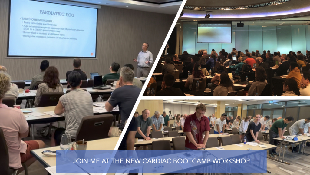 Can the ECG help us differentiate PE from ACS? | Resus