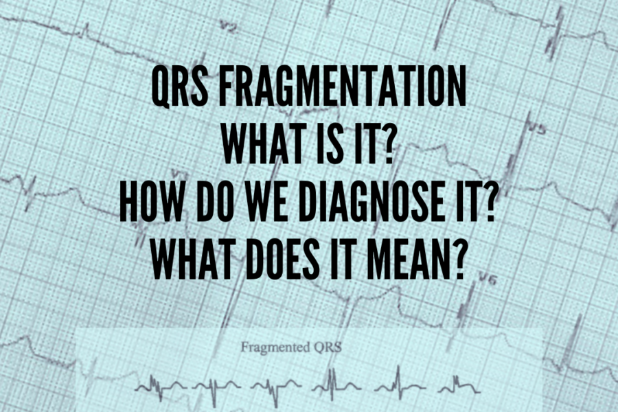ECG Of The Week Category | Emergency Medicine | Resus