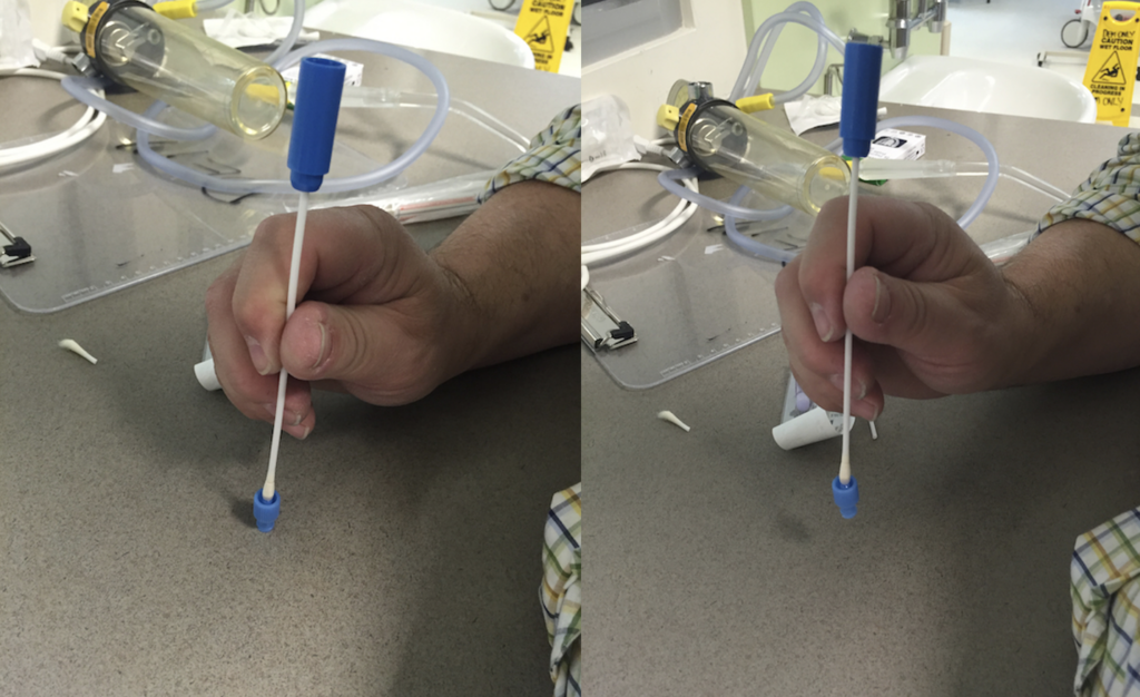 Foreign Body in the Ear: Is that a Spider? | Resus